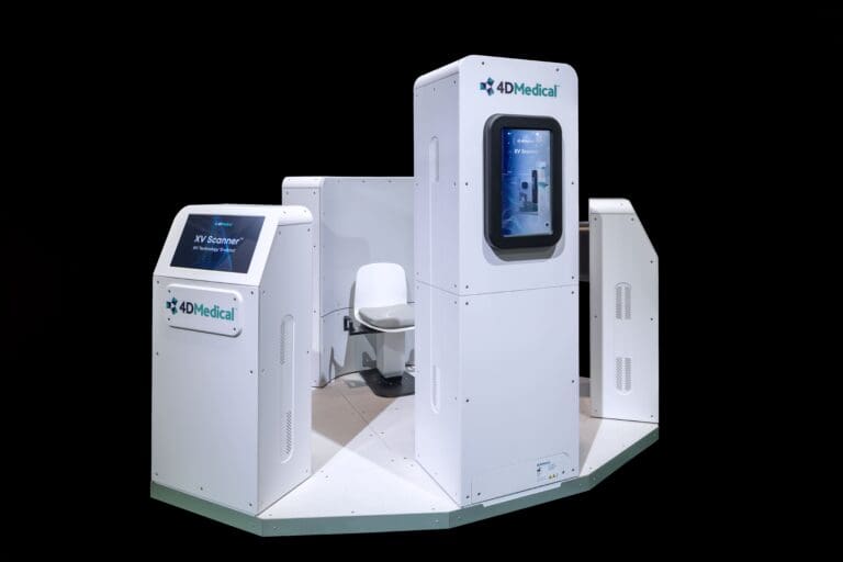 XV Scanner for Lung Airflow Imaging | 4DMedical