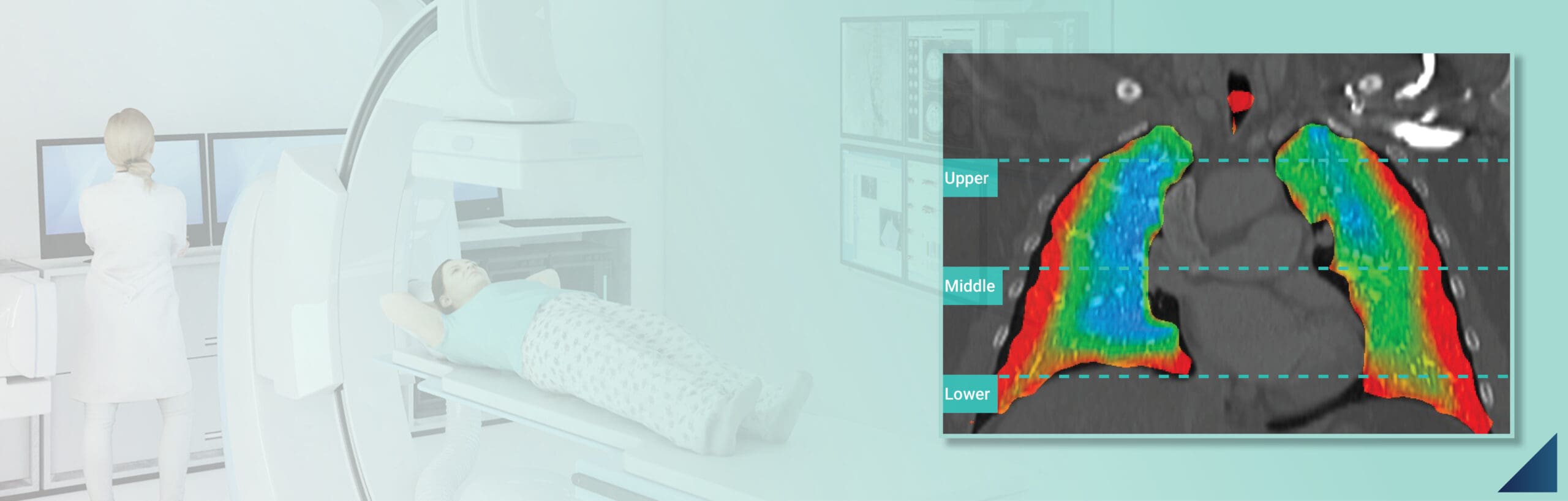 XV LVAS Lung Airflow Imaging Software | 4DMedical