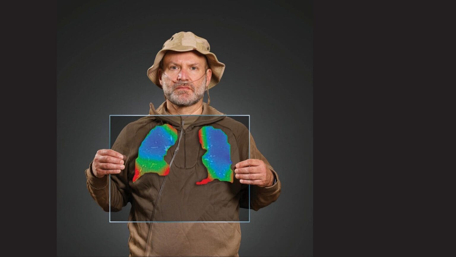 4D Lung Function Imaging, Analysis, & Testing | 4DMedical